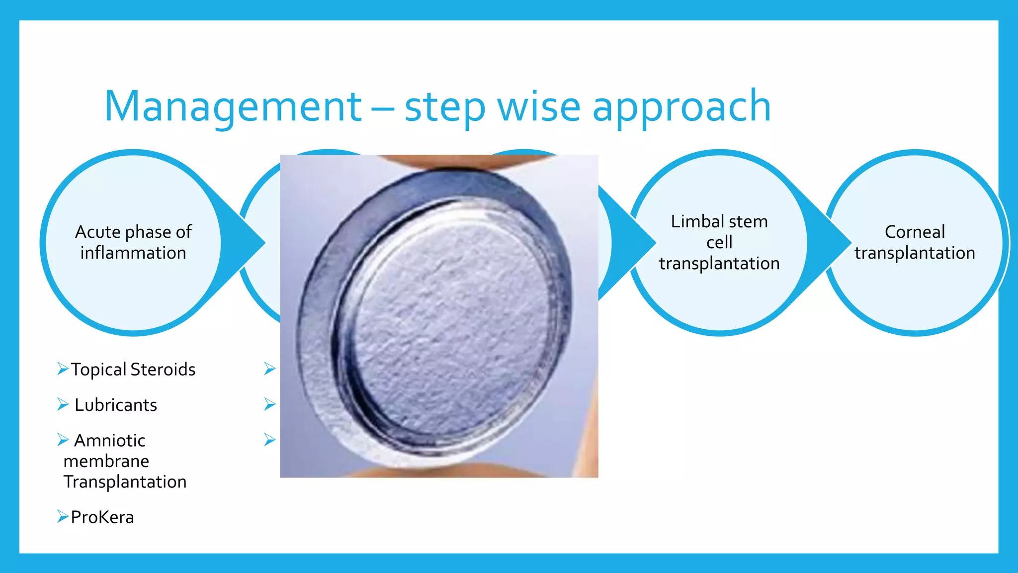 Limbal Stem Cell Deficiency & its management | PPTX