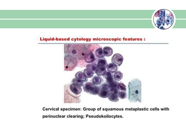 Laser scanning cytometry and liquid based cytology | PPT