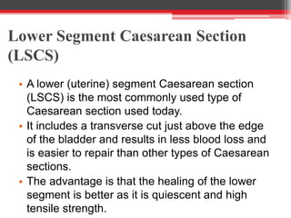 Lscs and Vbac | PPTX