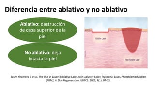 Terapia L ser En Dermatolog a PPTX Terapia L ser En Dermatolog a PPTX