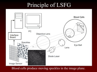 Lsfg introduction for_english_rev.2.00