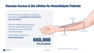 Vascular Therapies PowerPoint Presentation | PPTX