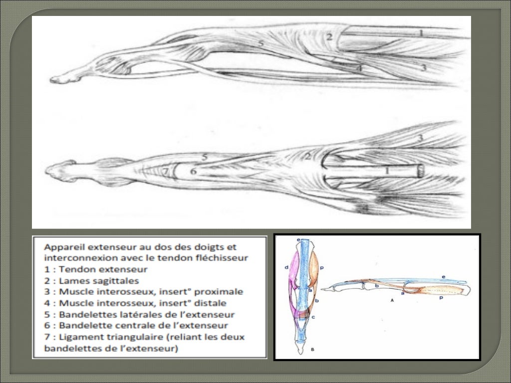 Lésion Des Tendons Extenseurs , REPARATION DES TENDONS EXTENSEURS DES ...