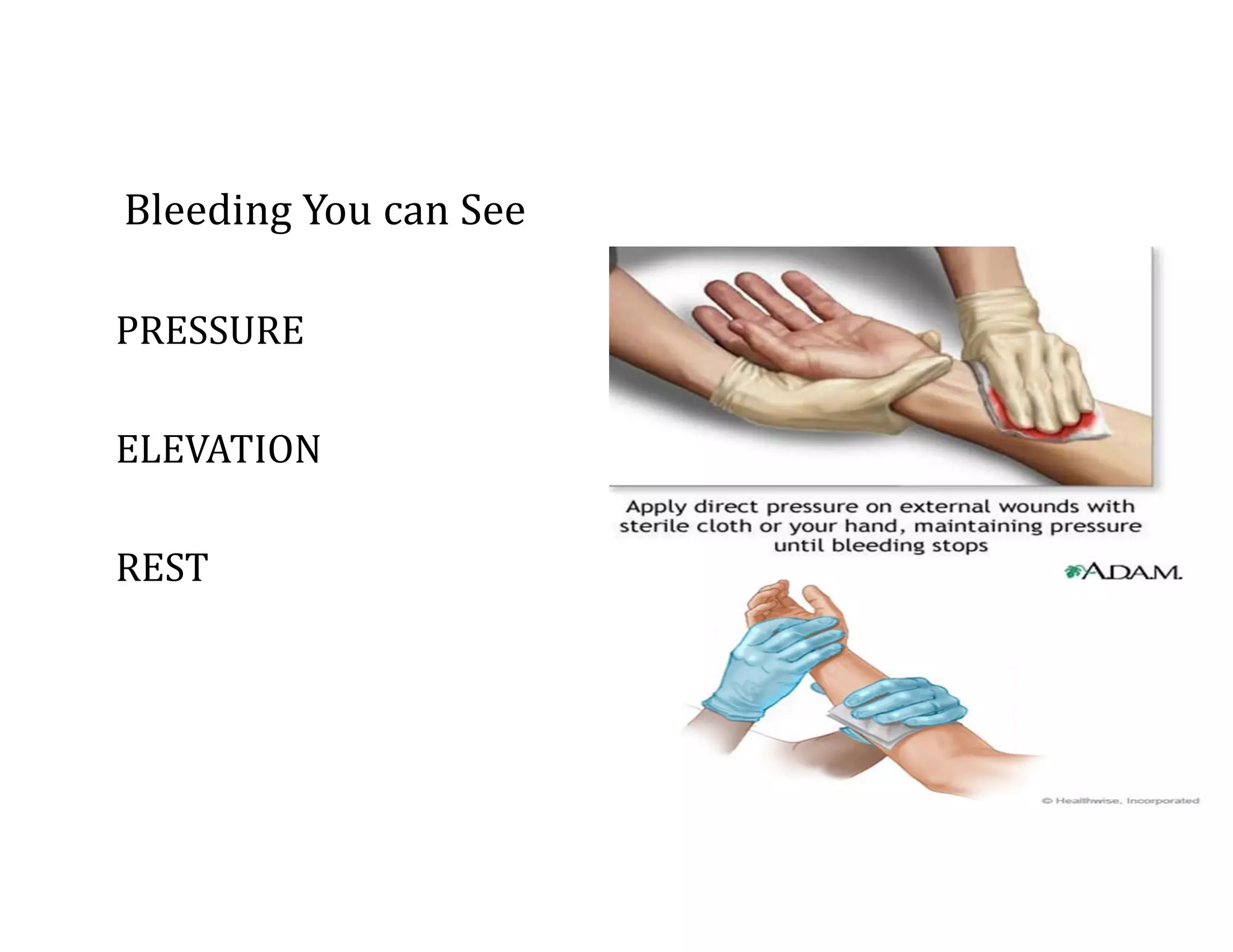 Lecture 7: first aid, choke, CPR, diabetes, bleed, burn | PDF