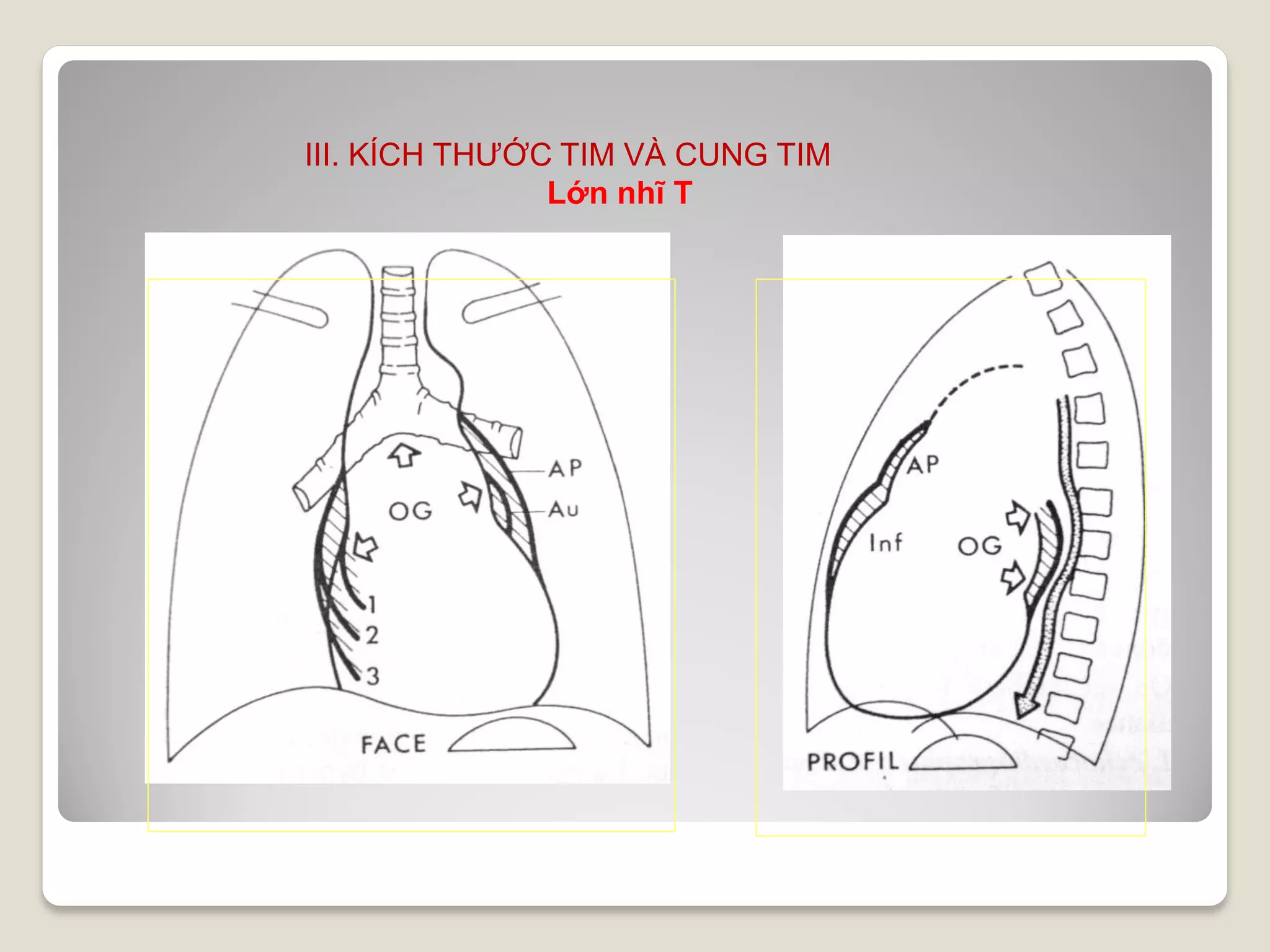 X QUANG TIM BẨM SINH | PDF