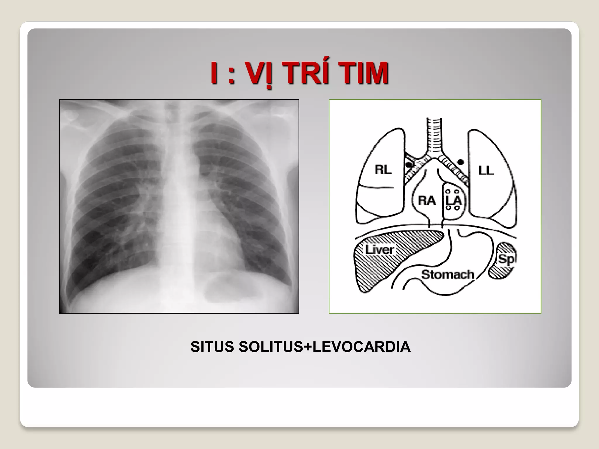 X QUANG TIM BẨM SINH | PDF