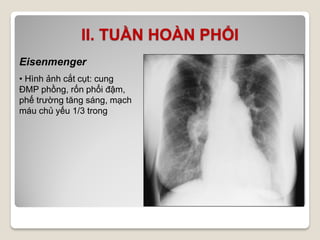 X QUANG TIM BẨM SINH | PDF