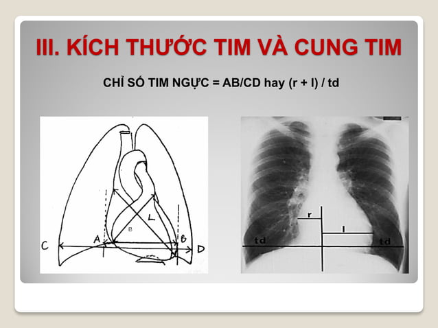 X QUANG TIM BẨM SINH | PDF