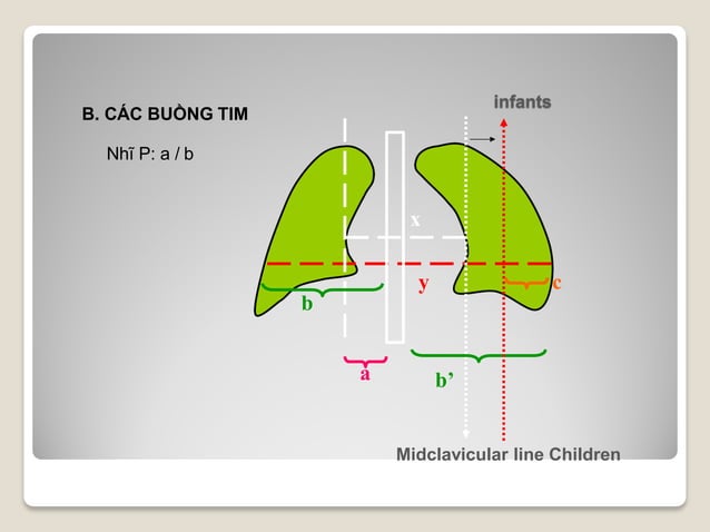 X QUANG TIM BẨM SINH | PDF