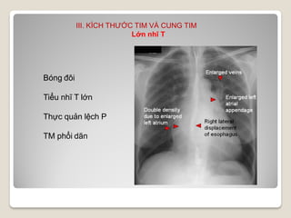 X QUANG TIM BẨM SINH | PDF