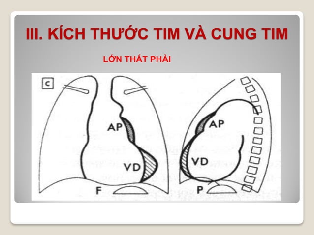 X QUANG TIM BẨM SINH | PDF