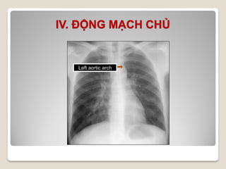 X QUANG TIM BẨM SINH | PDF