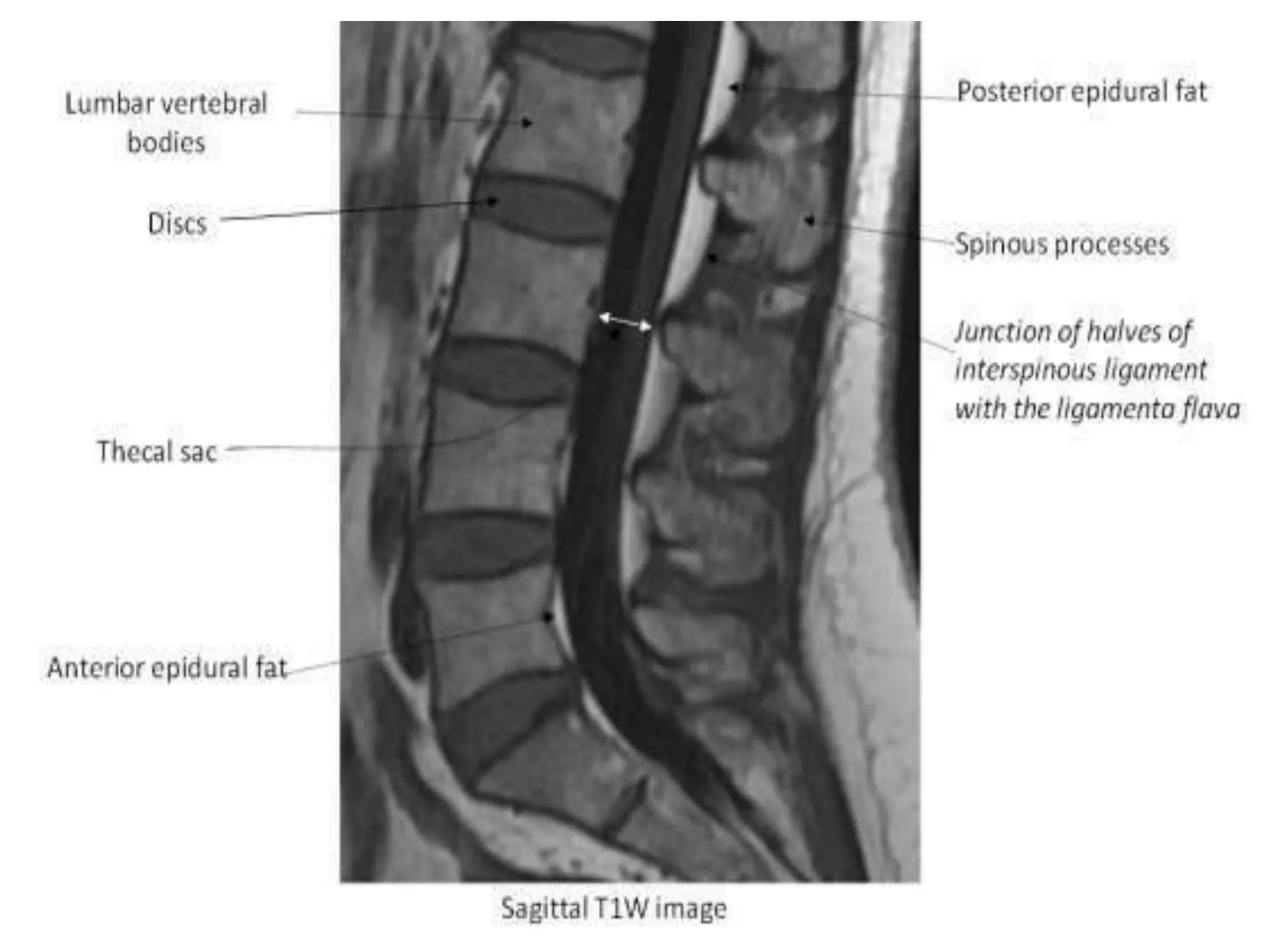 ls spine lecture.pptx