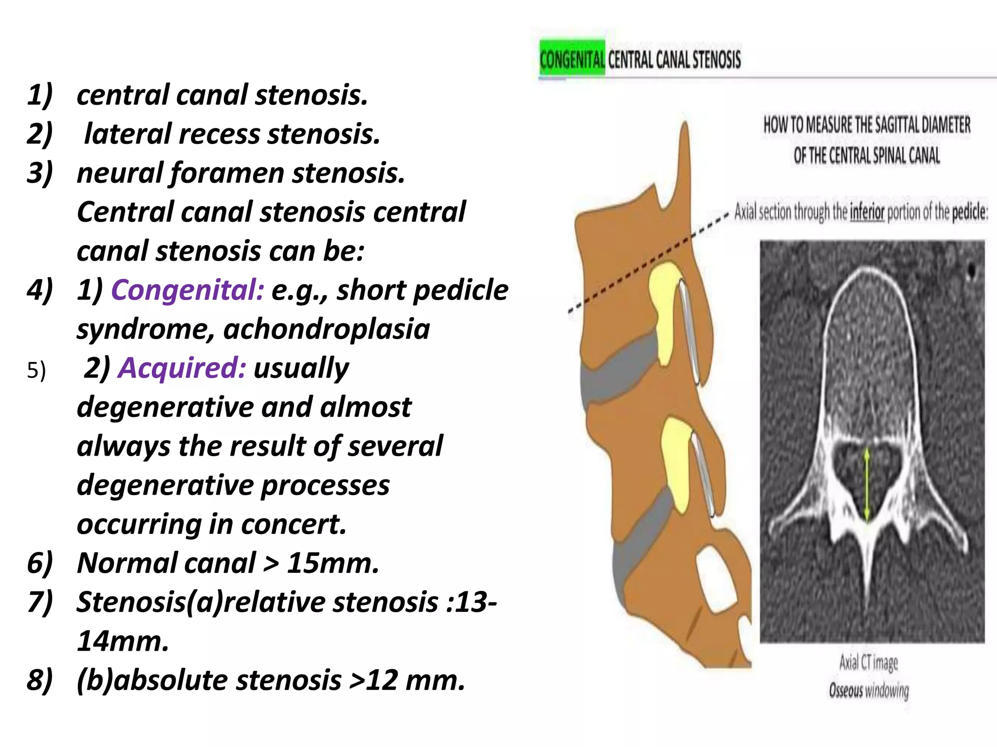 ls spine lecture.pptx