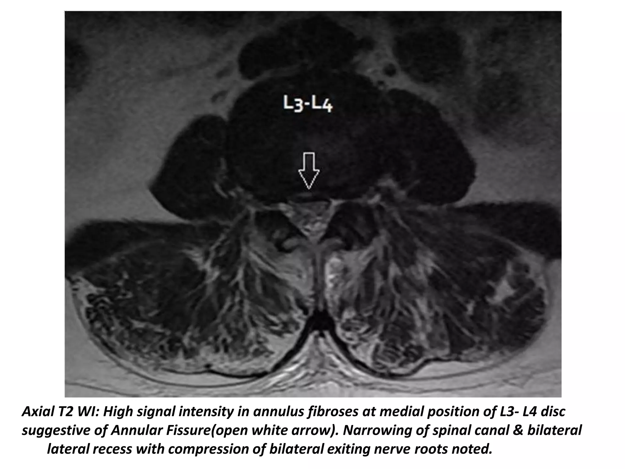 ls spine lecture.pptx