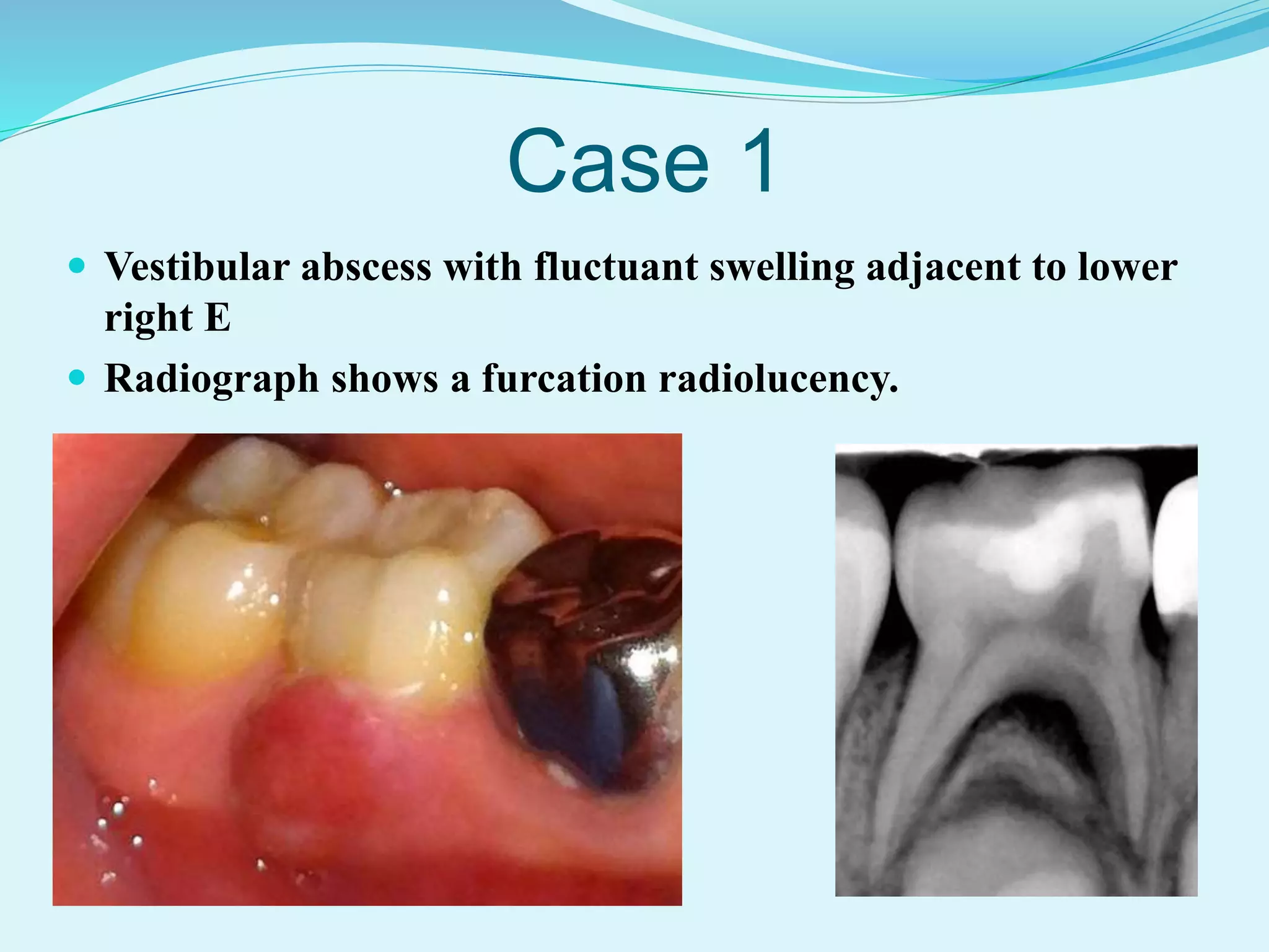 Lesion Sterilization & Tissue Repair | PPTX
