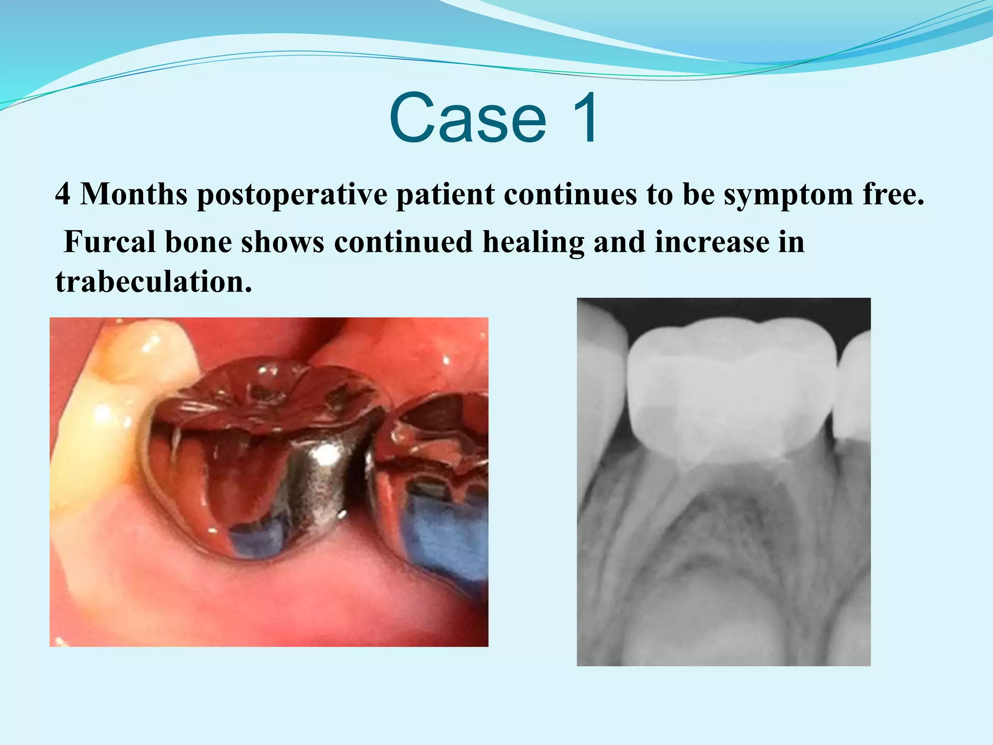 Lesion Sterilization & Tissue Repair | PPTX