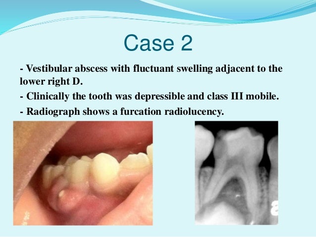 Lesion Sterilization & Tissue Repair