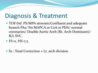 Double Aortic Arch with TOF | PPTX