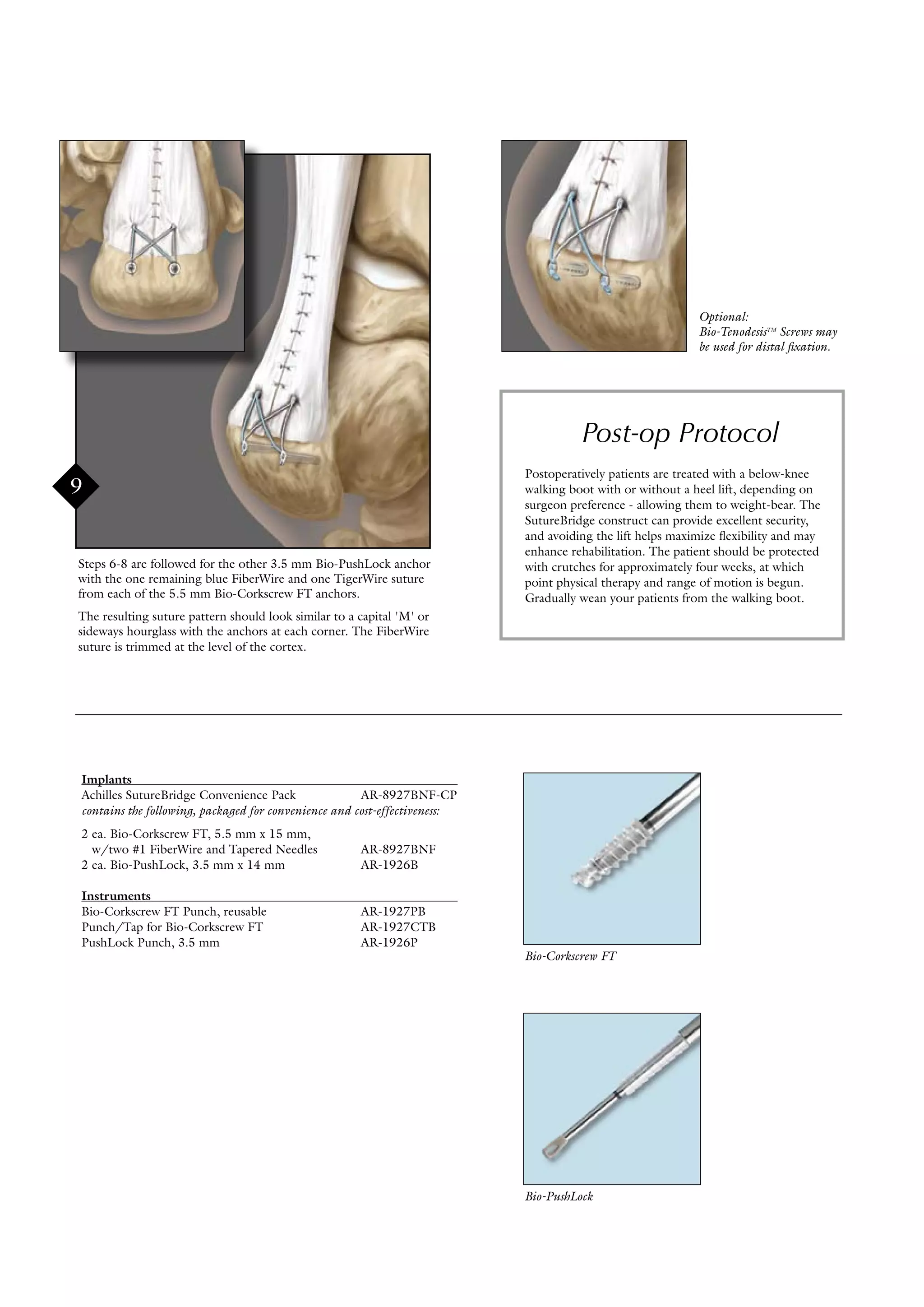 Lt0460 b achilles suturebridge | PDF
