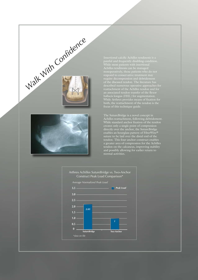 Lt0460 b achilles suturebridge | PDF | Foot Health | Diseases and ...