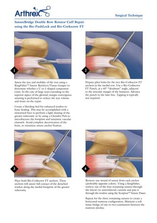 Lt0515 d suturebridge | PDF