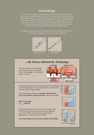 Lt0515 d suturebridge | PDF
