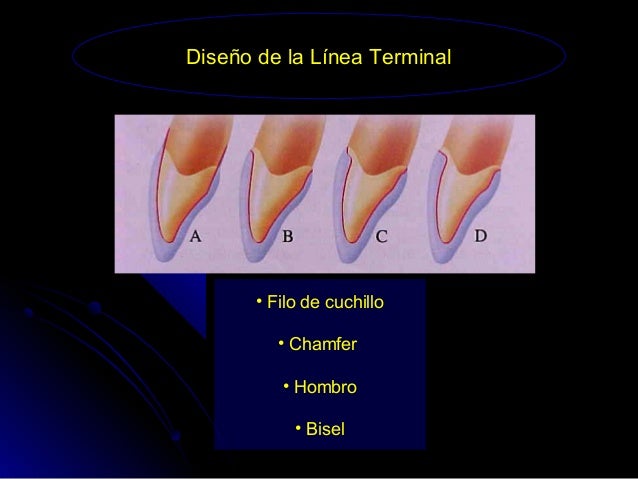 lineas terminales, impresiones definitivas, provisional