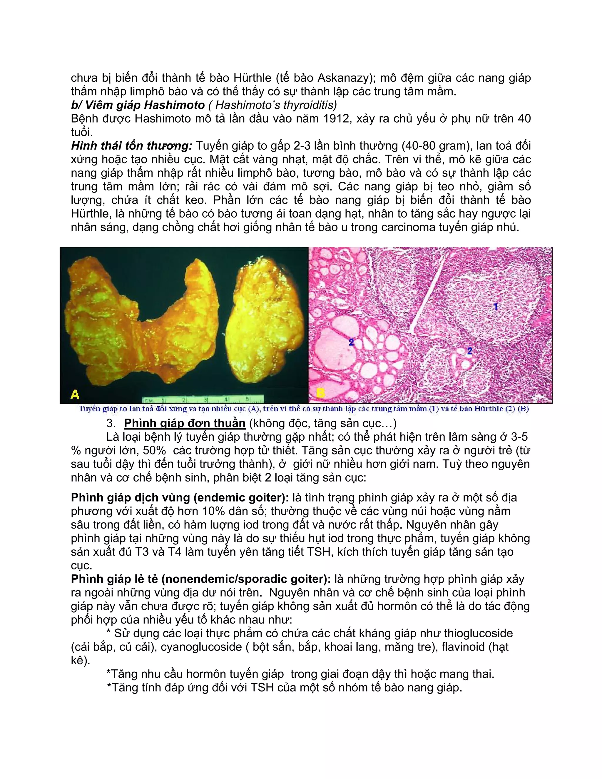 GIẢI PHẪU BỆNH HỌC HỆ NỘI TIẾT | PDF