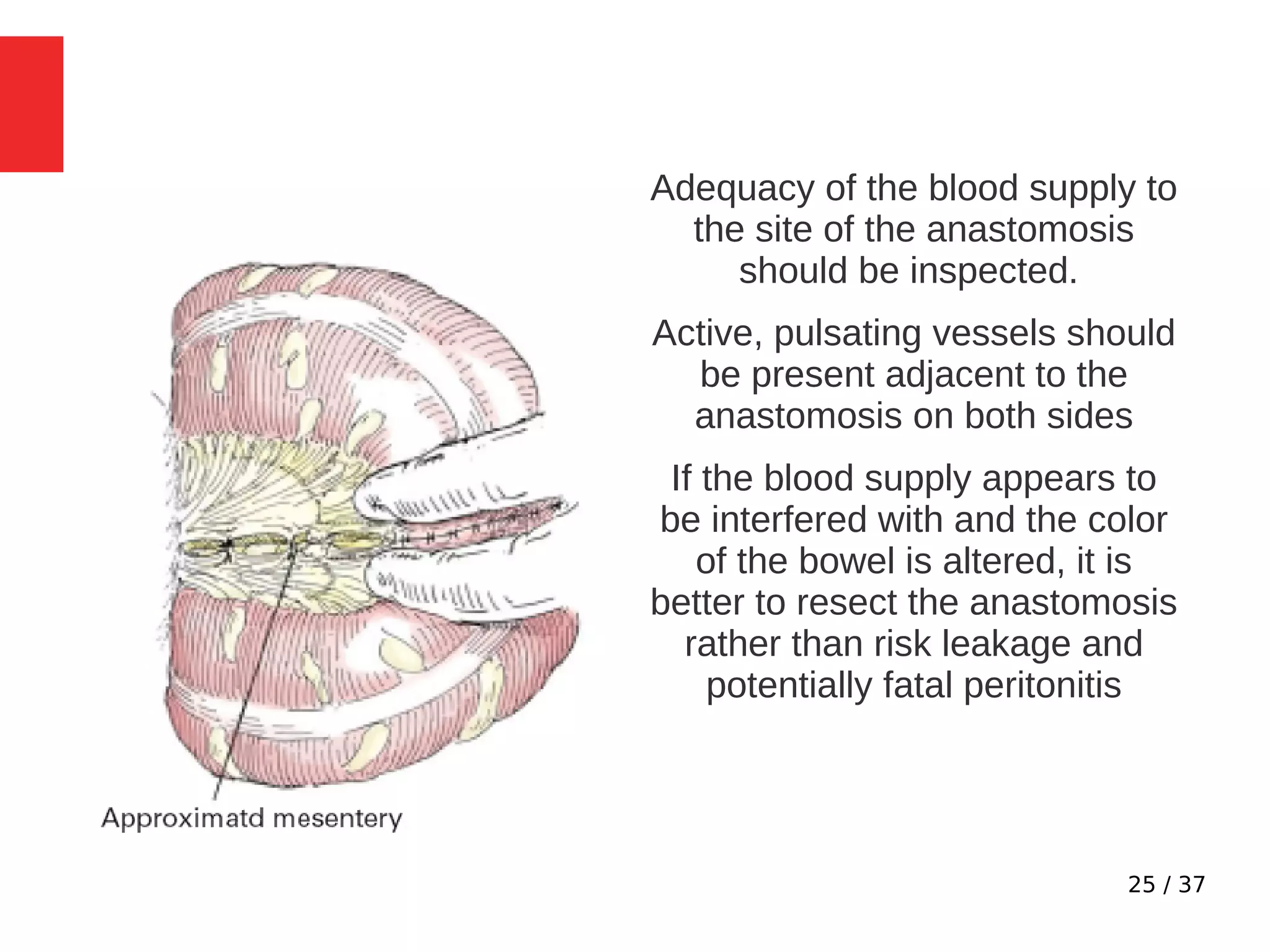 Lt hemicolectomy - Surgical Approach, Complications. | PDF
