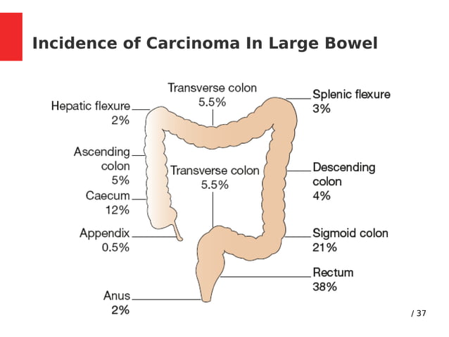 Lt hemicolectomy - Surgical Approach, Complications. | PDF