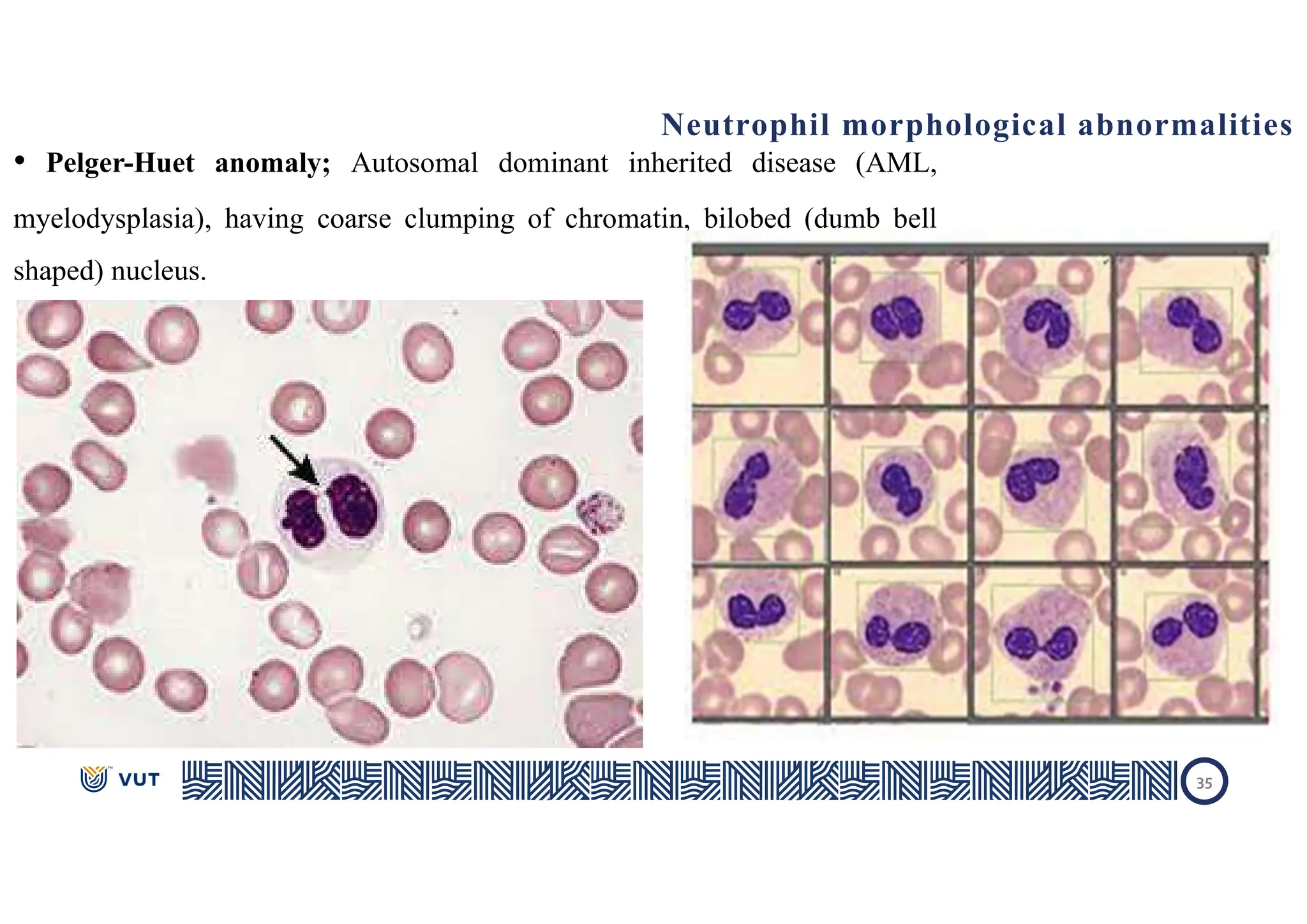 Hematology Granulopoiesis White blood cell production | PDF