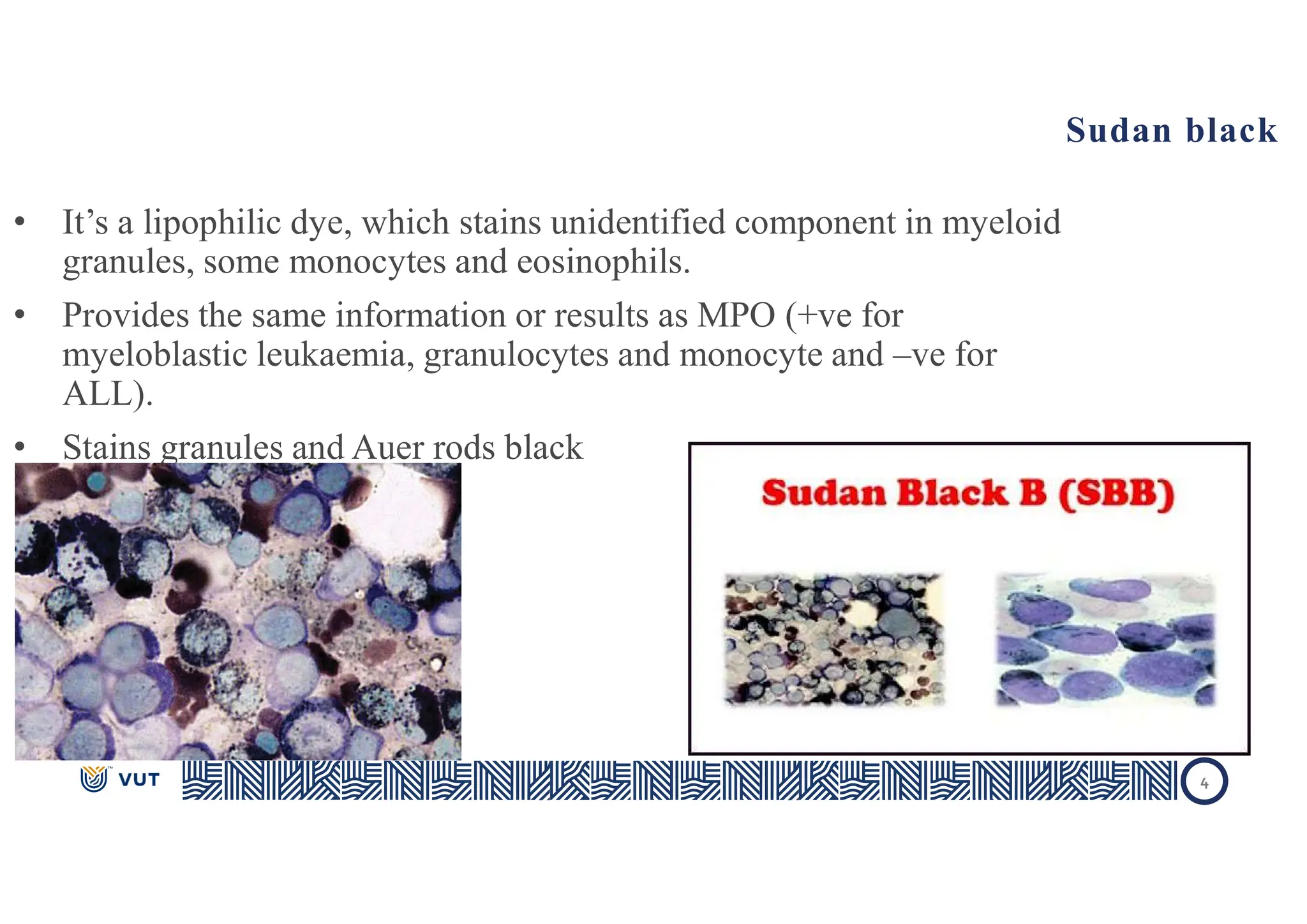LU7.pdf Haematology Special stains, diagnosing leukemia | PDF