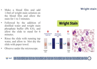 LU7.pdf Haematology Special stains, diagnosing leukemia | PPT