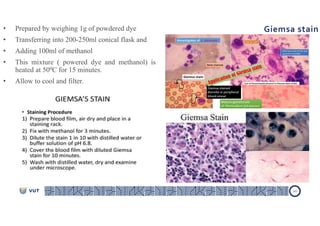 LU7.pdf Haematology Special stains, diagnosing leukemia | PDF