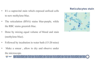 LU7.pdf Haematology Special stains, diagnosing leukemia | PPT