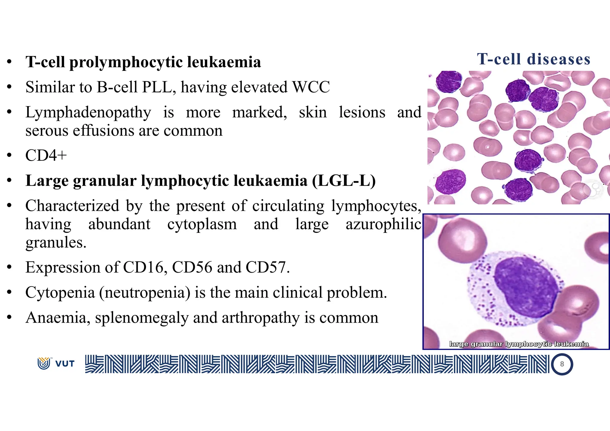 LU9.pdf Haematology Lymphoproliferative disorders | PPT