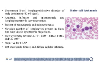 LU9.pdf Haematology Lymphoproliferative disorders | PDF
