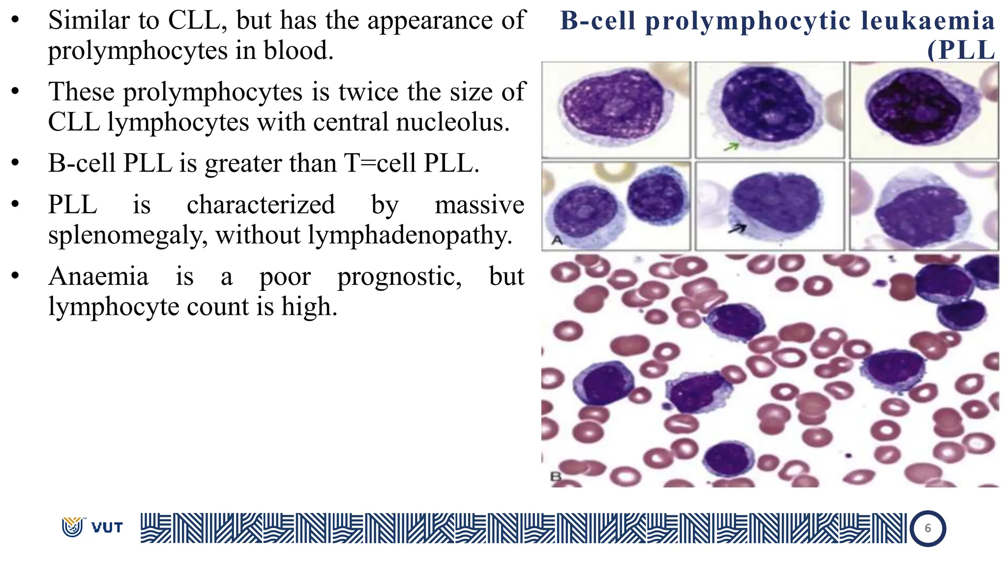 LU9 Haematology Lymphoproliferative disorders.pptx