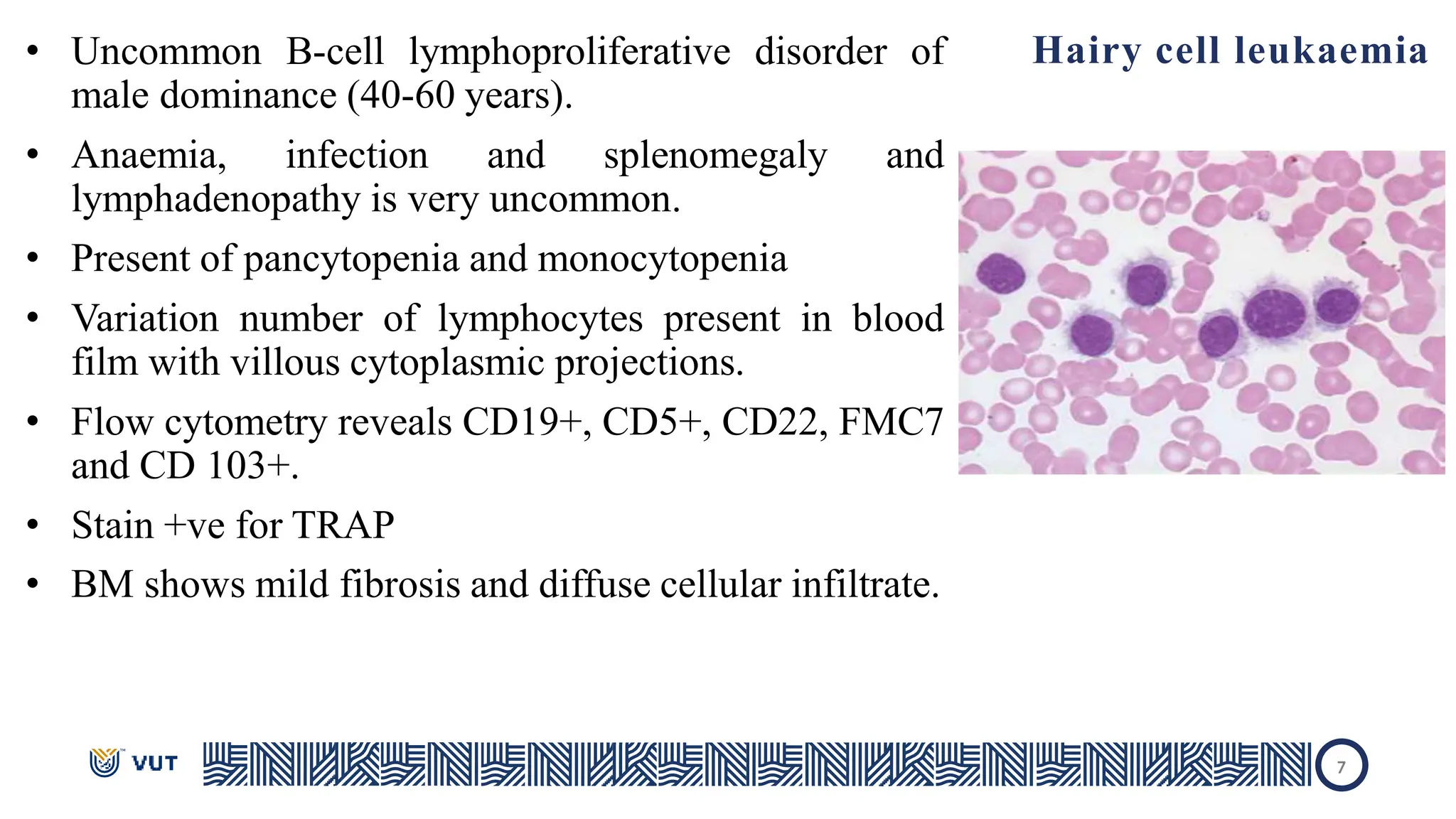 LU9 Haematology Lymphoproliferative disorders.pptx