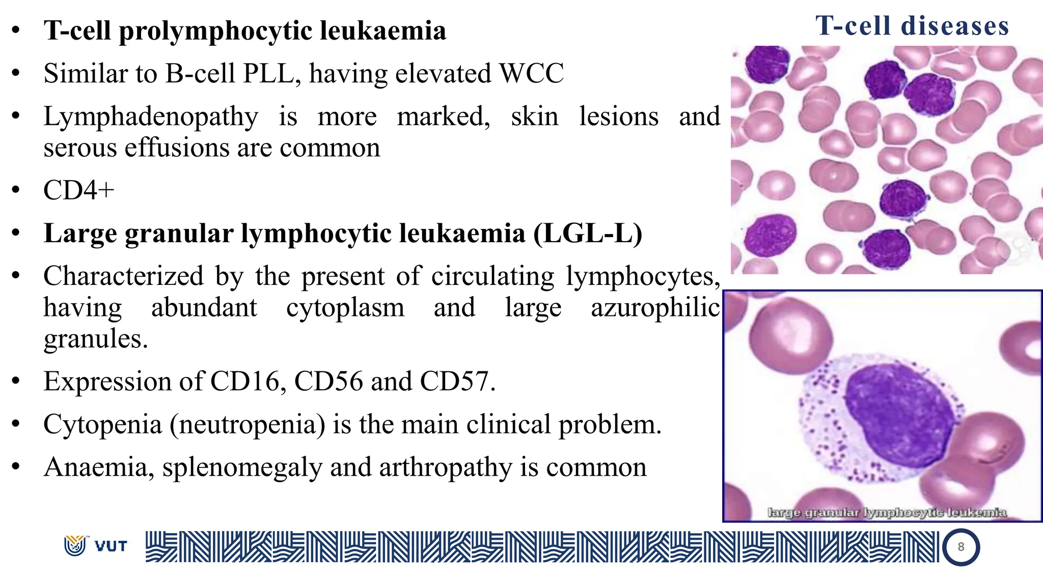 LU9 Haematology Lymphoproliferative disorders.pptx