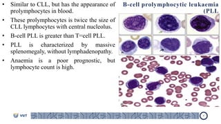 LU9 Haematology Lymphoproliferative disorders.pptx
