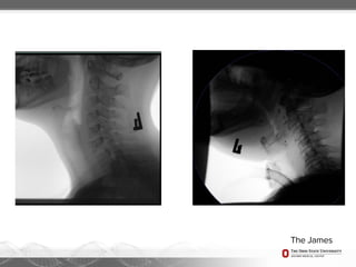 SLP Case Study | PPT