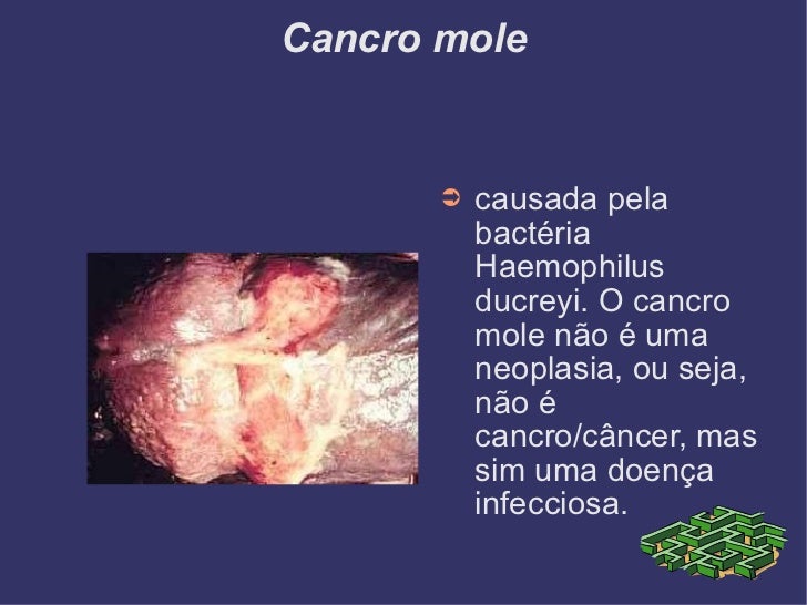 Doenças Causadas pelas DSTs