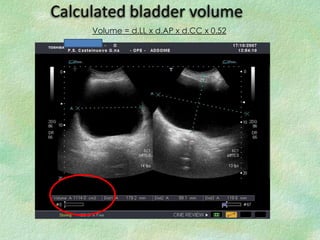 Ecografia applicata all'infermieristica | PPTX | Physical Therapy ...