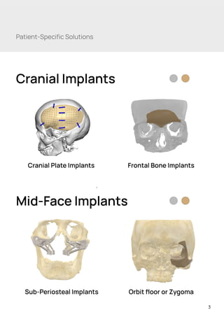 LUCID_Implants.pdf