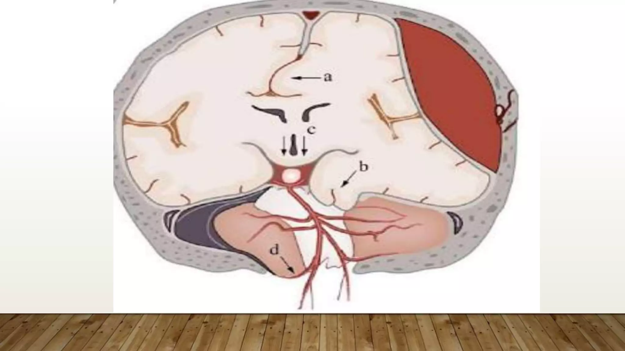 lucid interval and its importance in trauma and mental health | PPTX