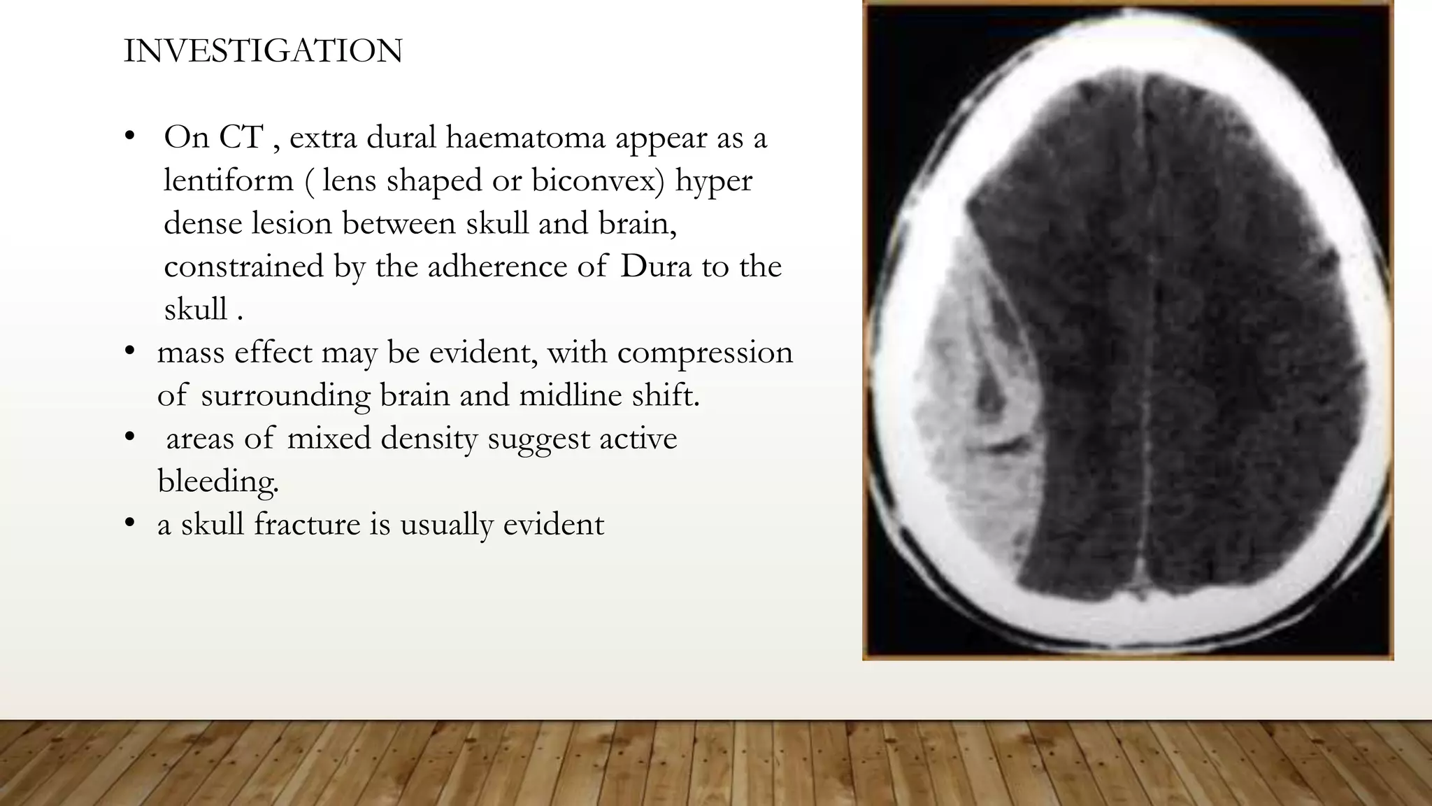 lucid interval and its importance in trauma and mental health | PPTX