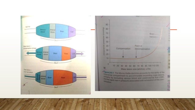 lucid interval and its importance in trauma and mental health | PPTX ...