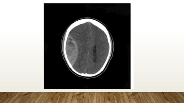 lucid interval and its importance in trauma and mental health | PPTX ...